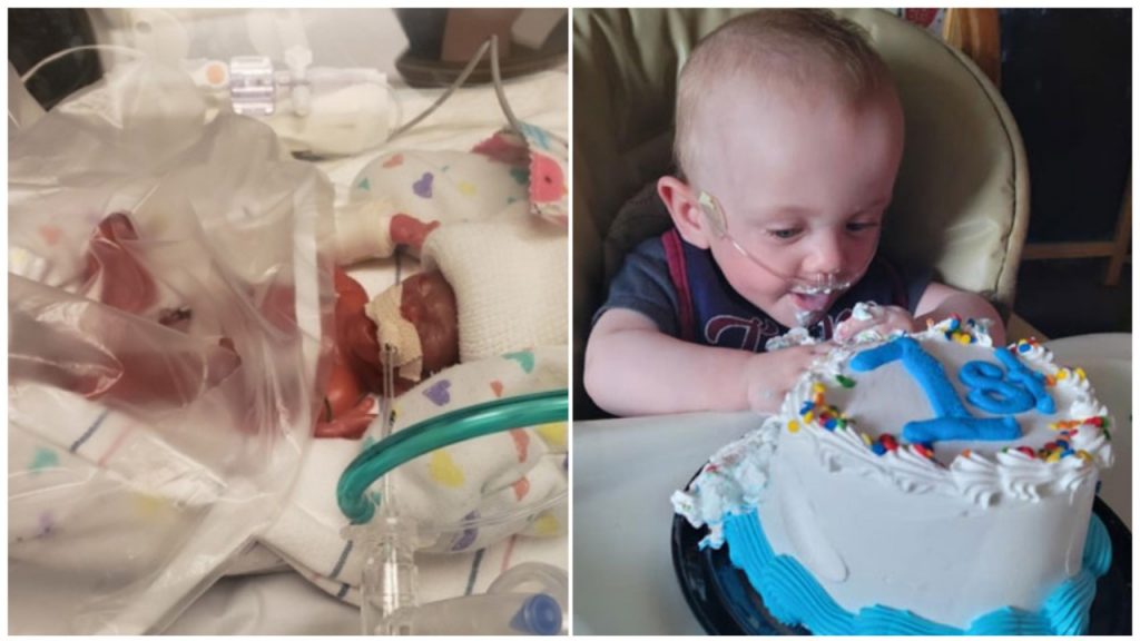 Najranije rođena beba na svijetu pobijedila 0 posto šanse za preživljavanje